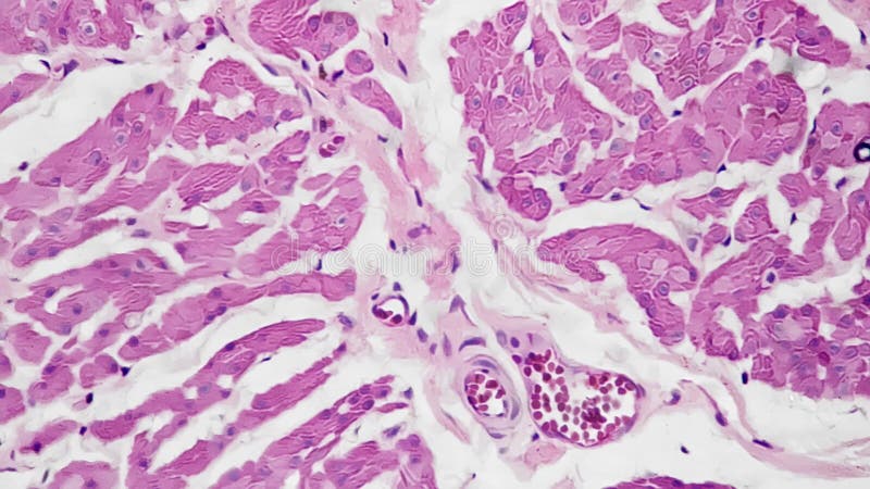 Stomach Fundic Portion in Section Filmed Under Microscope 200x on ...