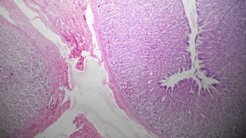 Stomach Fundic Portion in Section Filmed Under Microscope 200x on ...