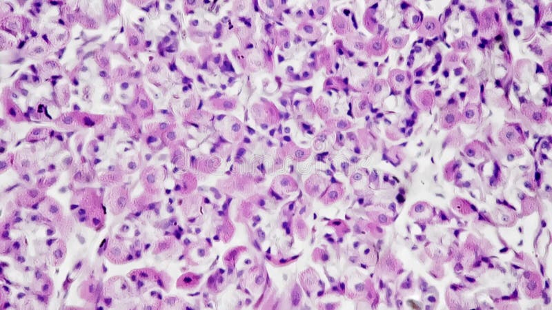 Stomach Fundic Portion in Section Filmed Under Microscope 400x on ...