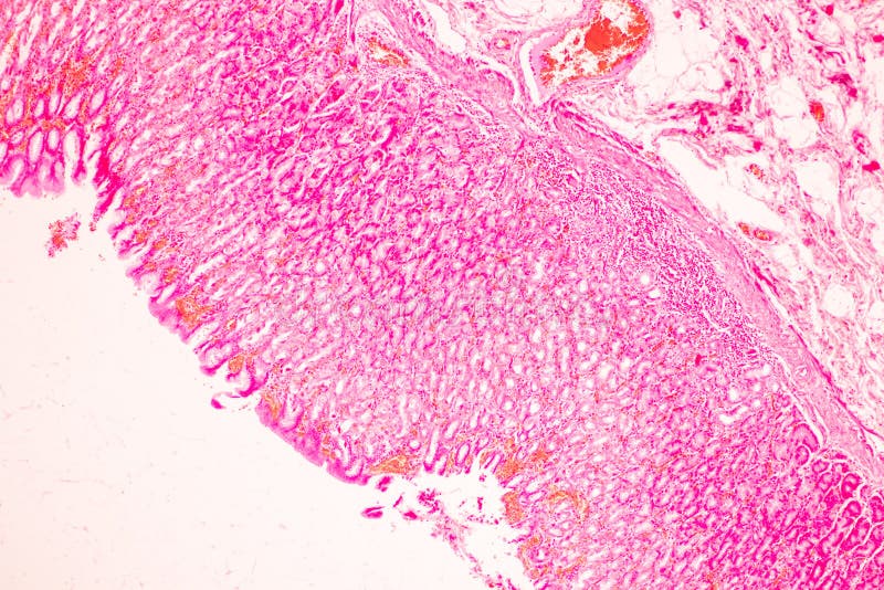 Tissue of Stomach Human Under the Microscope in Lab. Stock Image ...