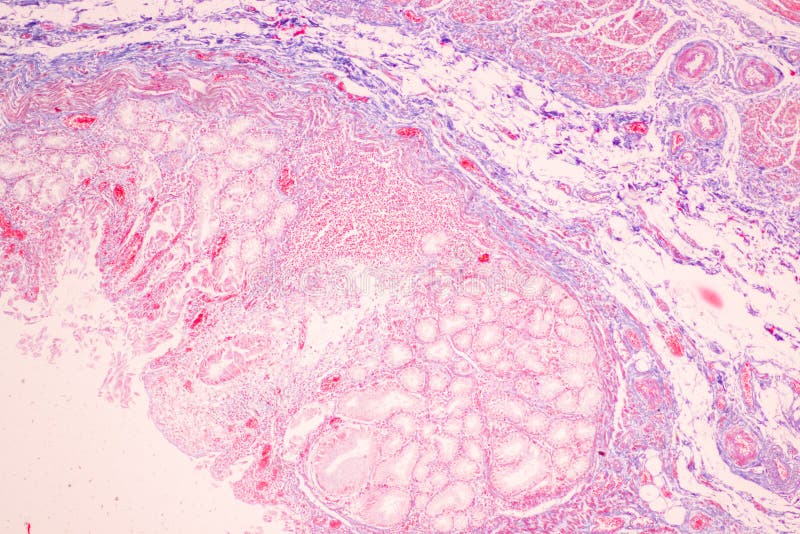 Tissue of Stomach Human Under the Microscope in Lab. Stock Photo ...