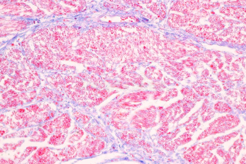 Tissue of Stomach Human Under the Microscope in Lab. Stock Image ...