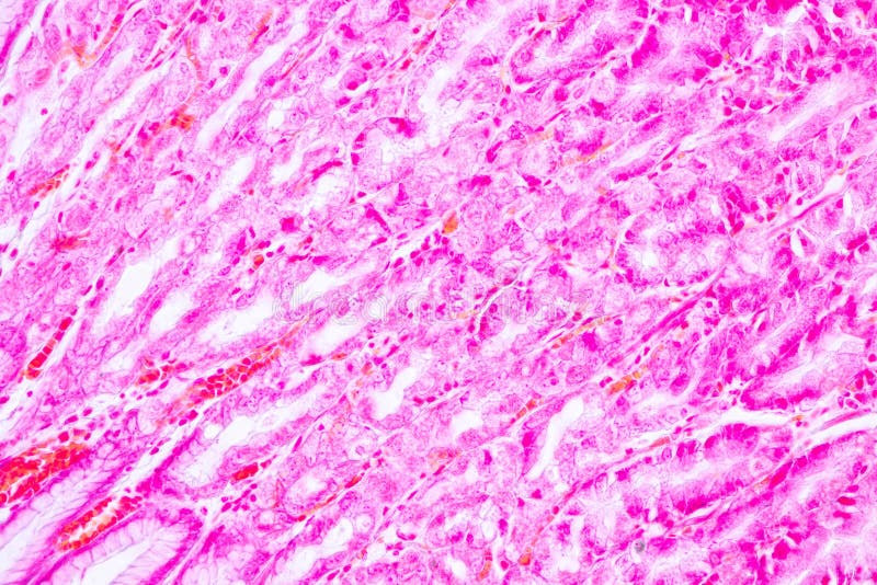 Tissue of Stomach Human Under the Microscope in Lab. Stock Image ...