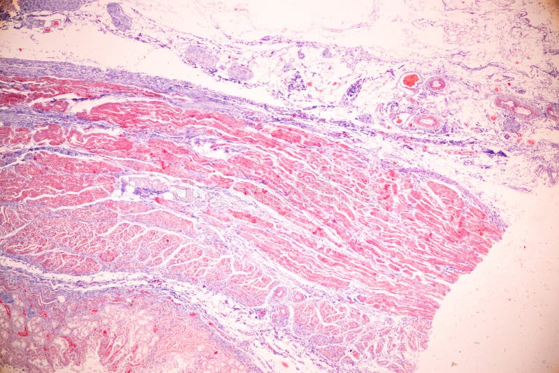 Tissue of Stomach Human Under the Microscope in Lab. Stock Photo ...