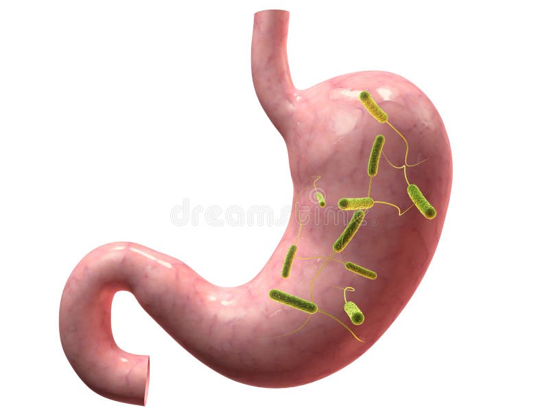 Stomach infection stock illustration. Illustration of cramp - 11734427