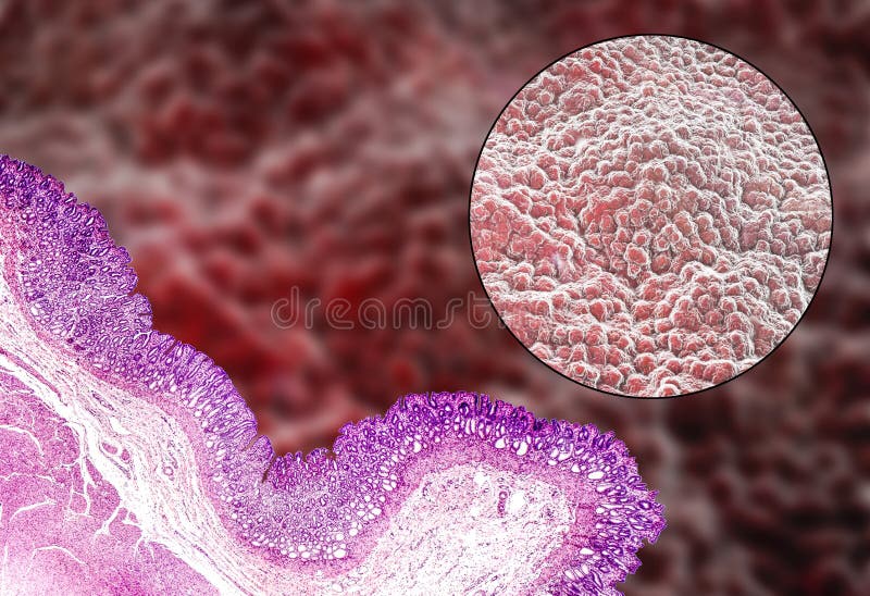 Stomach Mucosa, Micrograph and Illustration Stock Illustration ...
