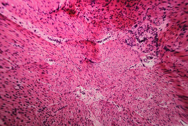 Stomaco Pilorico Microscopico Di Divisione Delle Cellule Fotografia ...