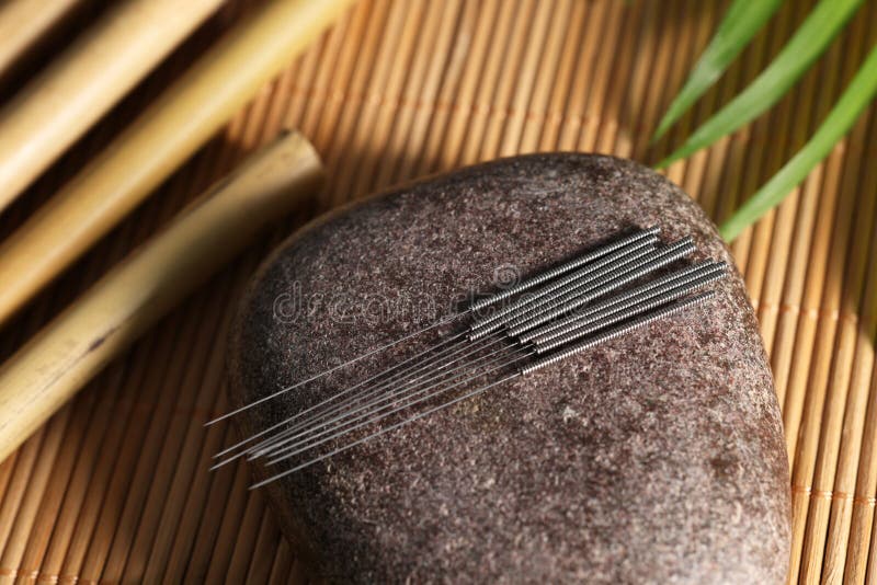 Stone with Acupuncture Needles on Bamboo Mat, Above View Stock Photo ...