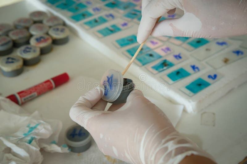 Stool Analysis Stool Examination Stool Test Stock Photo - Image of ...