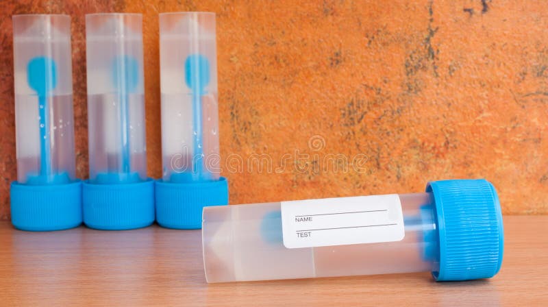 Stool Sample Jars with Transport Medium Stock Photo - Image of science ...
