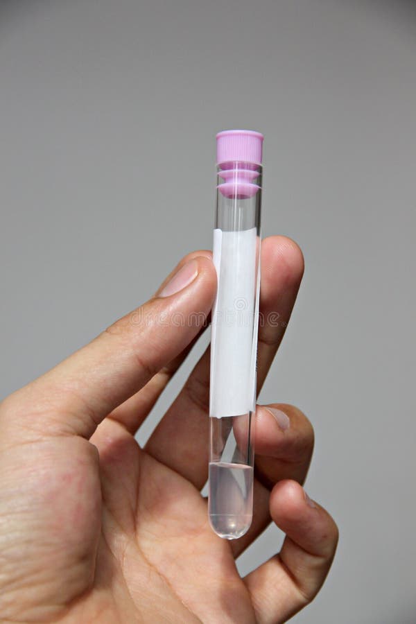 Stool test Tubes in hand. stock photo. Image of store - 35690990