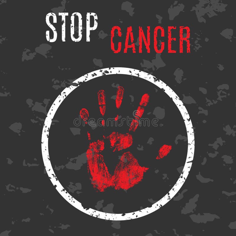 Stop cancer by prevention stock illustration. Illustration of prevent ...