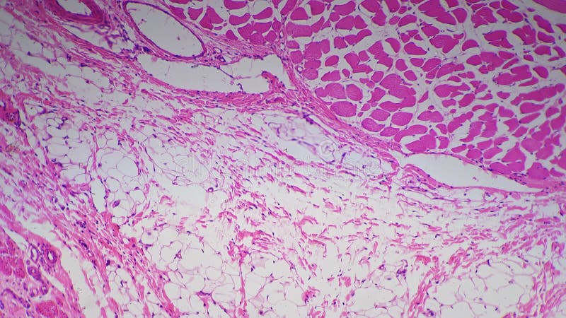 Stratified Squamous Epithelium In Section Filmed By Microscope 200x Against Bright Field Stock