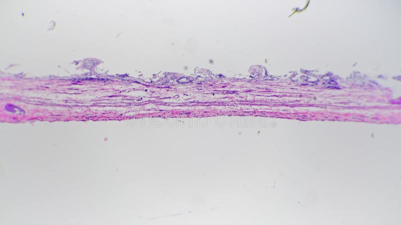 Stratified Squamous Epithelium in Section Filmed by Microscope 400x ...