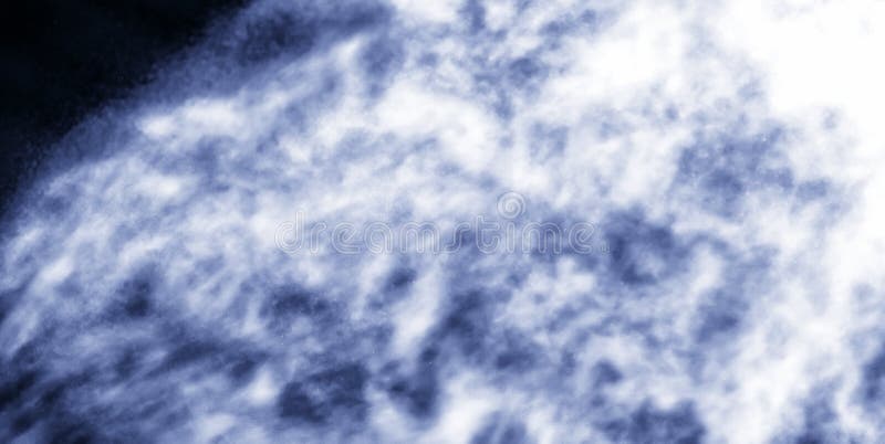 A Stream of Water and a Cloud of Drops Stock Photo - Image of health ...