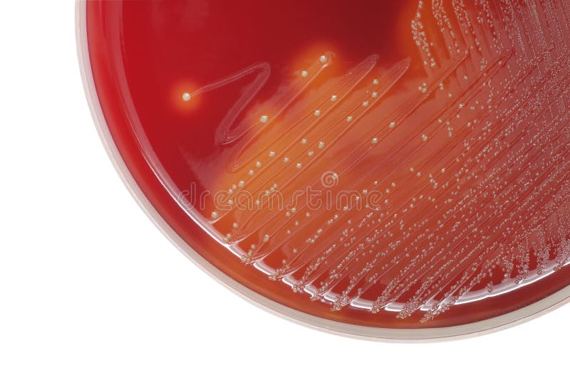 Colonie Batteriche Di Streptococcus Con Emolisi Beta Su Agar Sangue ...