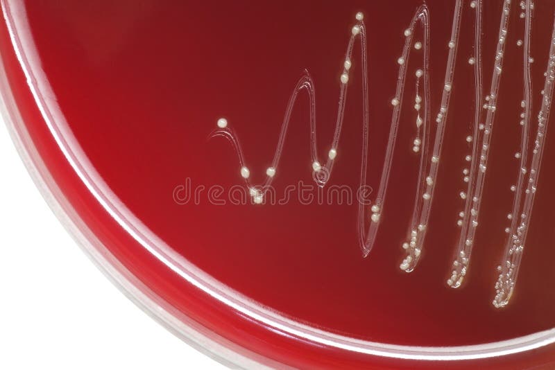 Streptococcus Bacterial Colonies with Alpha Hemolytic on Blood a Stock ...