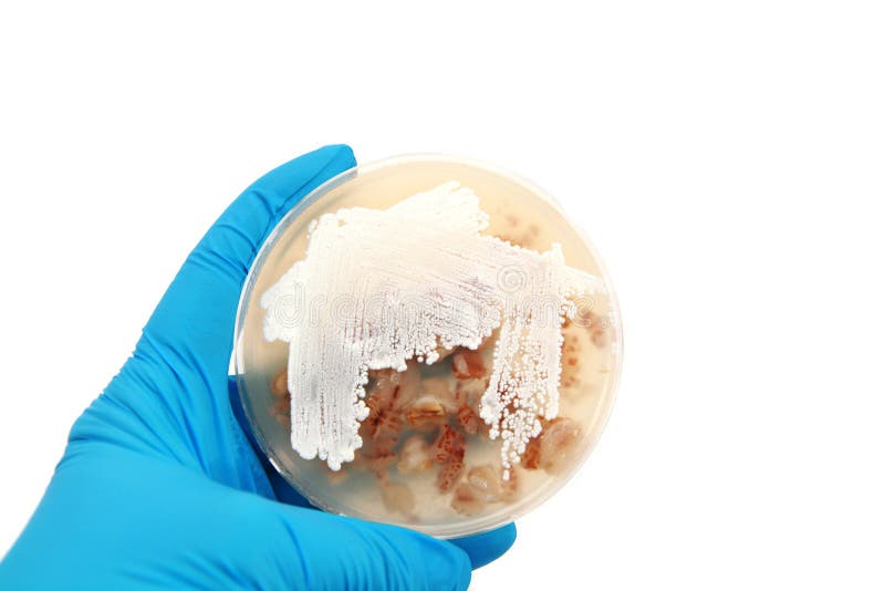 Streptomyces Bacteria On Agar Plate Royalty Free Stock Photos - Image ...