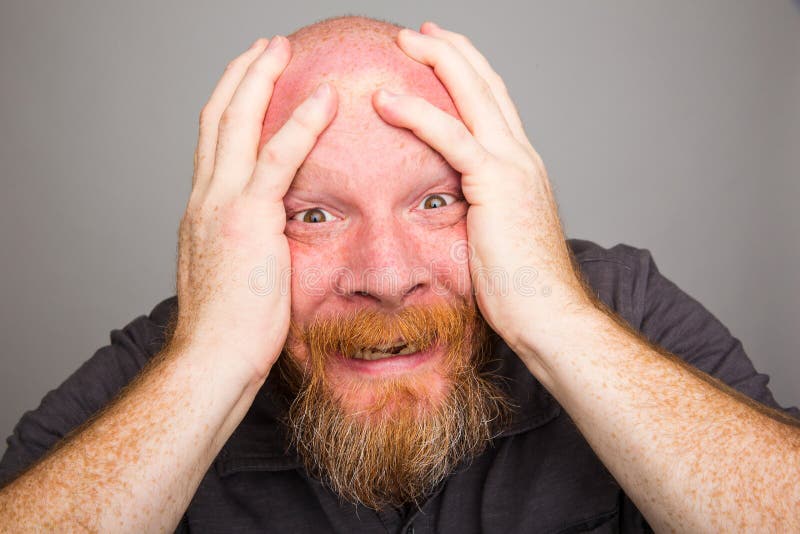 Bald Stressed Out Face Stock Photos - Free & Royalty-Free Stock Photos ...