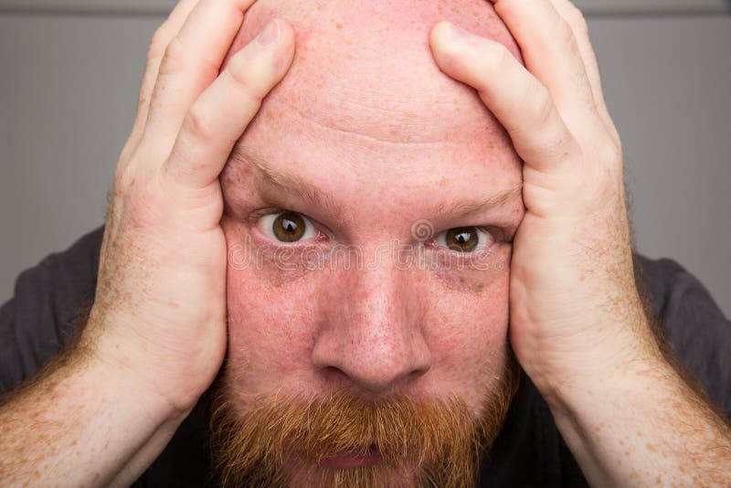 Bald Stressed Out Face Stock Photos - Free & Royalty-Free Stock Photos ...