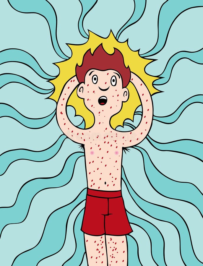 Stressed Man Develops Hives Stock Vector - Illustration of healthcare ...