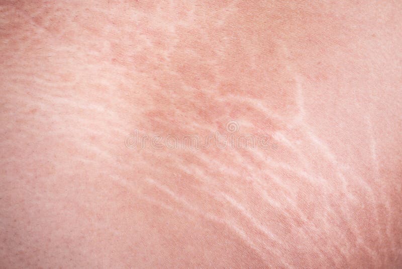 Human skin stock image. Image of background, textured - 17108889