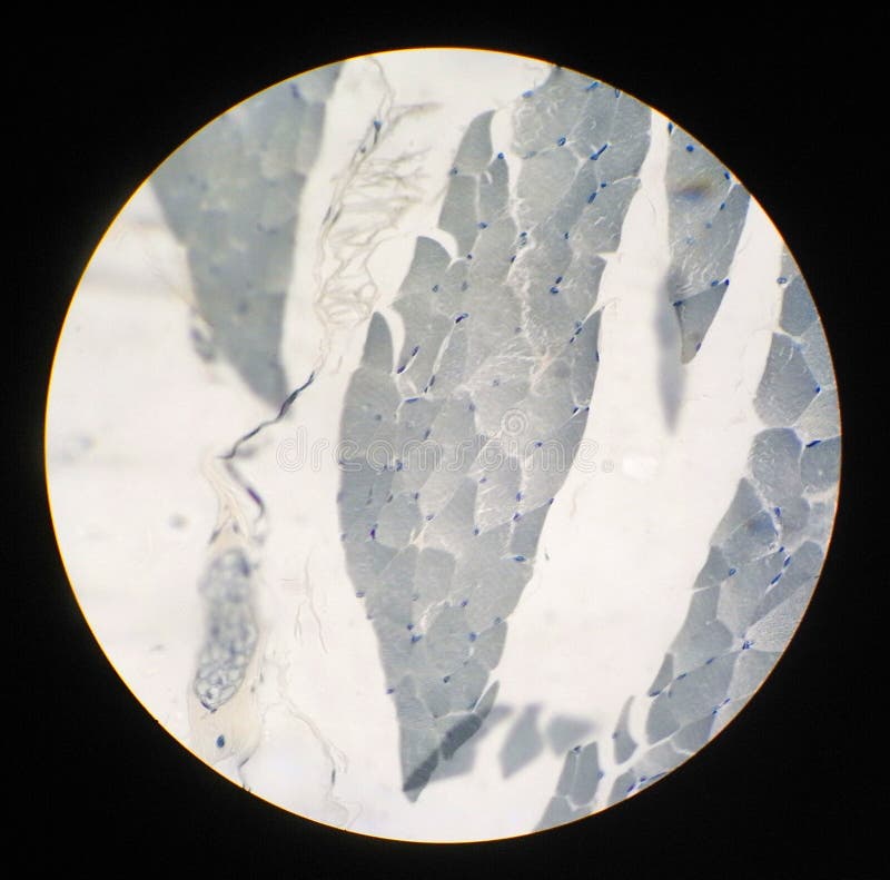 Striated Muscle Tissue Under the Microscope Stock Photo - Image of ...