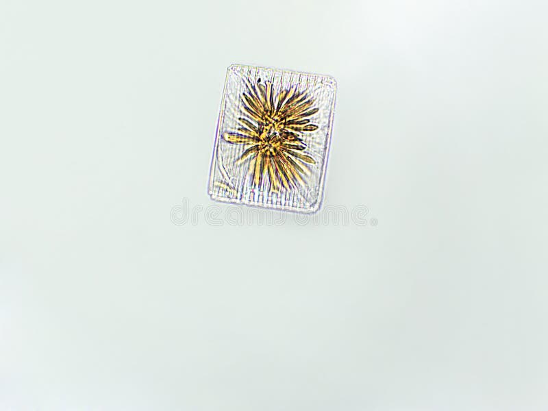 Striatella Sp. Algae Under Microscopic View, Diatom Algae Stock Photo ...