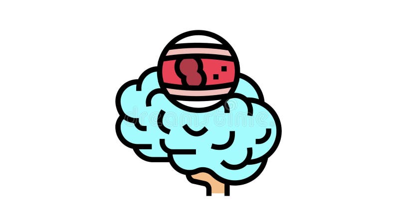 Stroke Brain Hemorrhage Disease Hospital Artery Trauma Neurosurgery ...