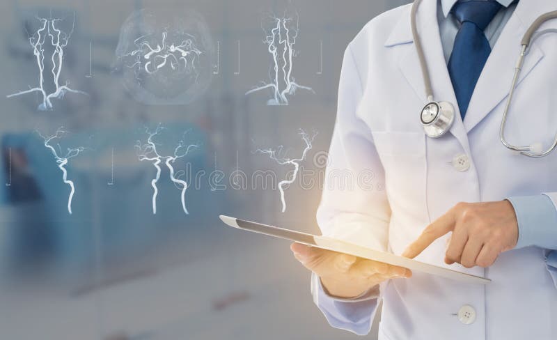 Stroke Brain Research Medical Stock Photo - Image of neurologist ...