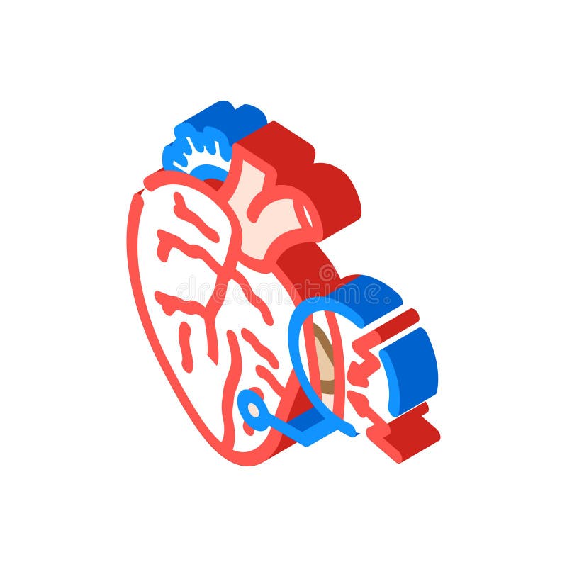 Stroke Caused Cardiovascular Issues Isometric Icon Vector Illustration ...