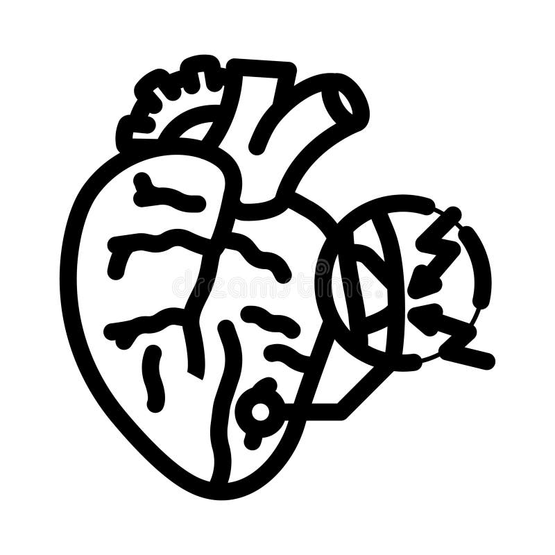 Stroke Caused Cardiovascular Issues Line Icon Vector Illustration Stock ...