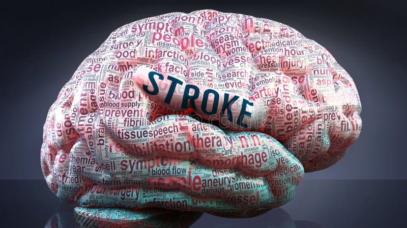 Stroke and a human brain stock photo. Image of anatomy - 247691162