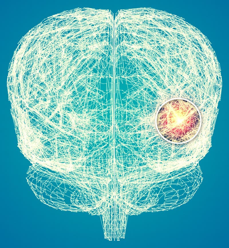 Brain Problems. Parkinson and Alzheimer Desease. Mental Health Stock ...