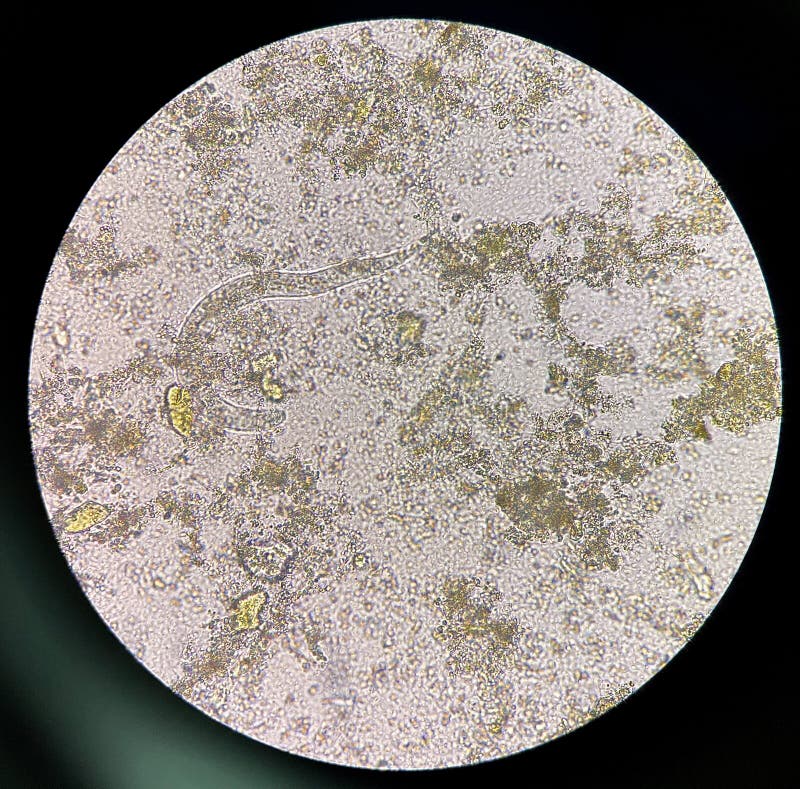 Strongyloides Stercoralis Larva in Stool Exam Stock Photo - Image of ...