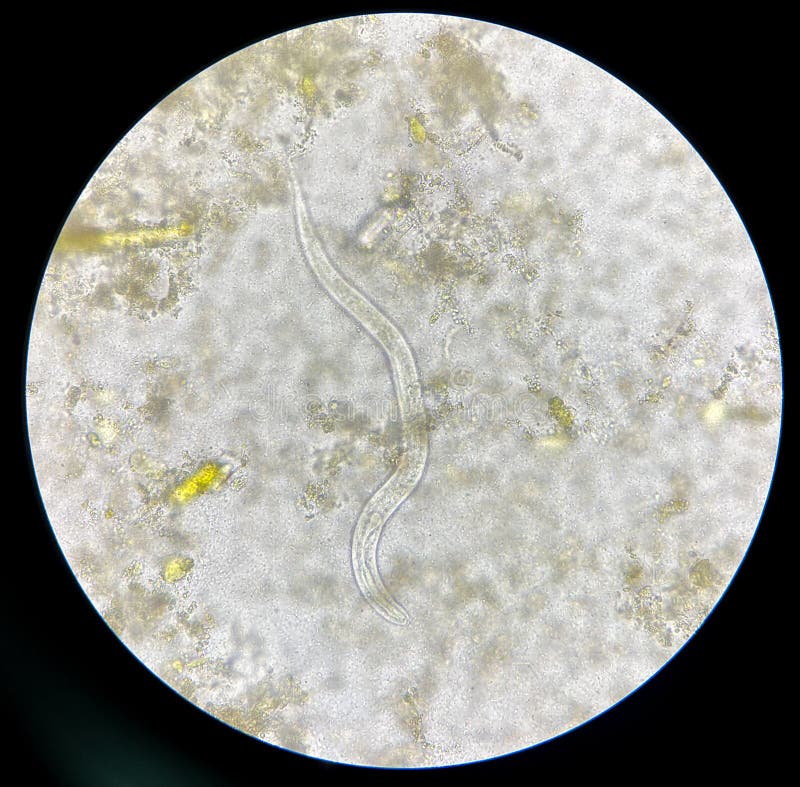 Strongyloides Stercoralis Larva in Stool Exam Stock Photo - Image of ...