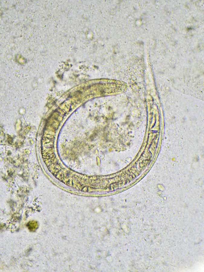 Strongyloides stercoralis stock image. Image of organism - 96910471