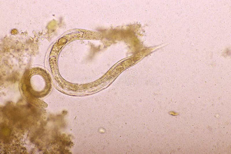 Strongyloides Stercoralis or Threadworm in Human Stool Stock Image ...