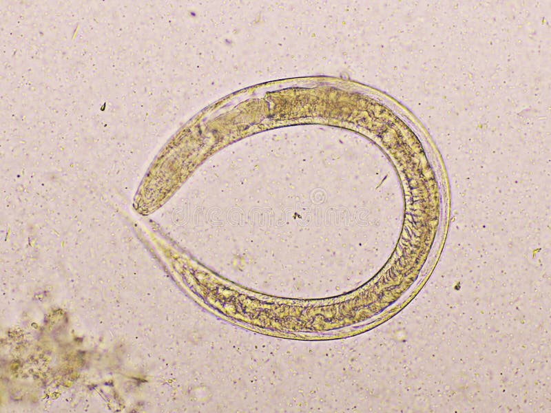 Strongyloides Stercoralis or Threadworm in Human Stool Stock Image ...