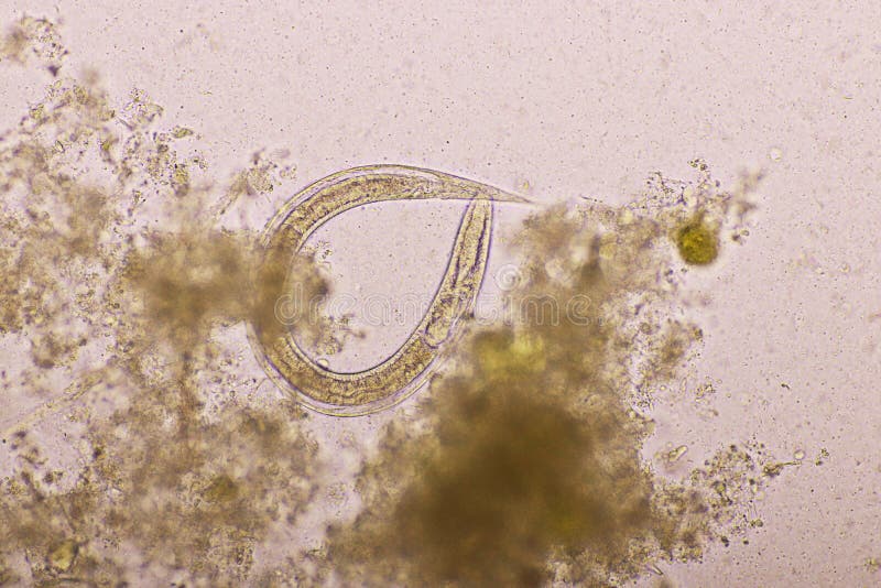 Strongyloides Stercoralis or Threadworm in Human Stool Stock Image ...