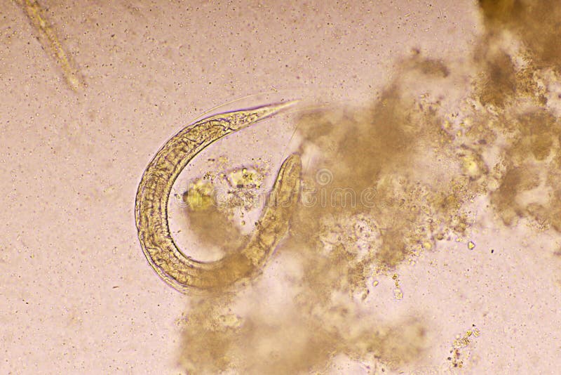 Strongyloides Stercoralis or Threadworm in Human Stool Stock Image ...