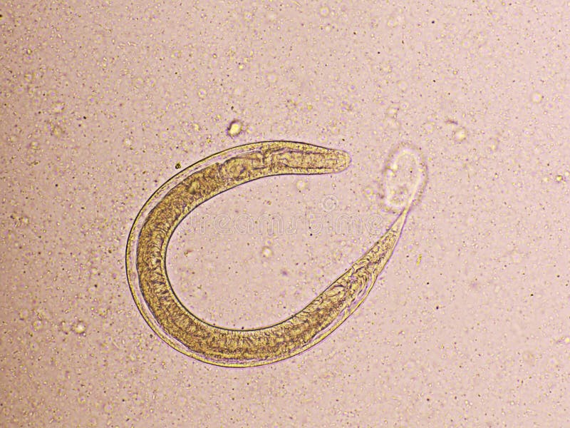 Strongyloides Stercoralis or Threadworm in Human Stool Stock Image ...