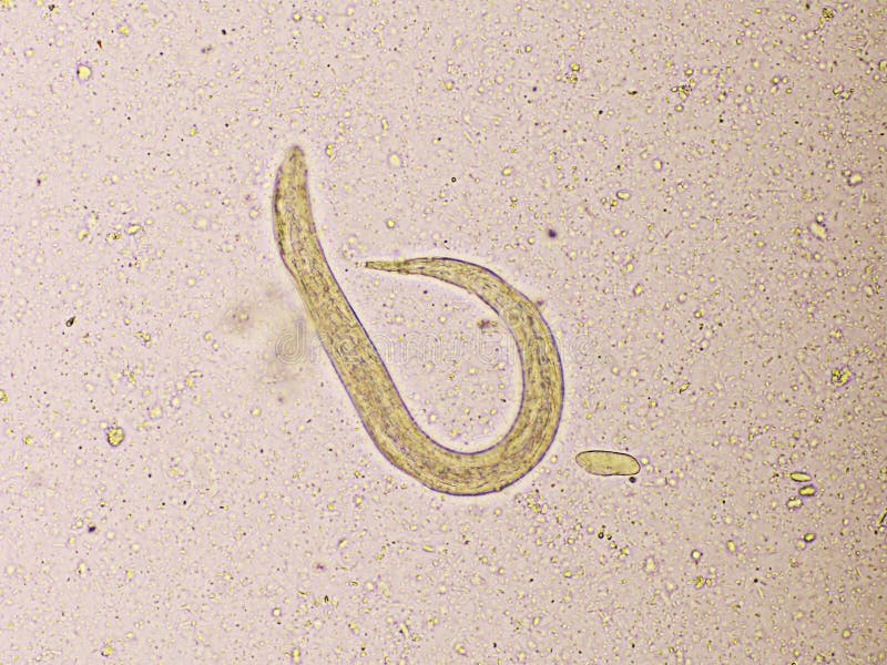 Strongyloides Stercoralis in Human Stool Stock Image - Image of ...