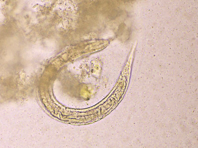Strongyloides Stercoralis or Threadworm in Human Stool Stock Photo ...