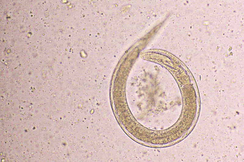 Strongyloides Stercoralis or Threadworm Stock Photo - Image of larva ...