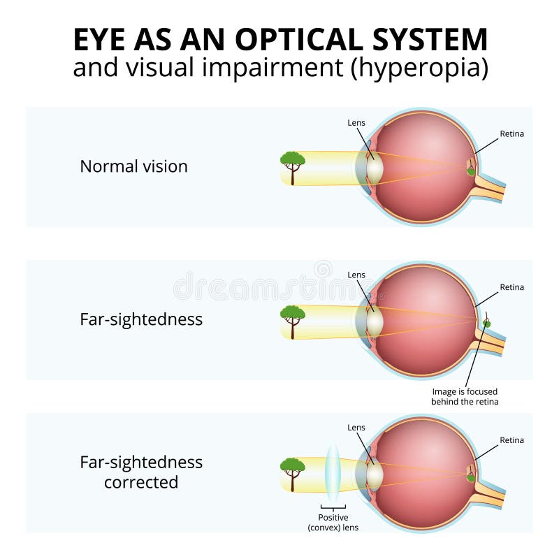 Schematic Diagram of the Human Eye Anatomy Stock Vector - Illustration ...