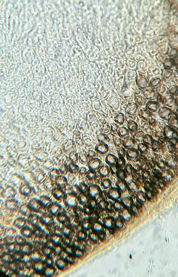 The Structure of the Myelin Nerve Fiber Under the Microscope Stock ...