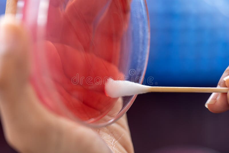 Study for Bacteria Staphylococcus Aureus in the Human Nose. Stock Image ...