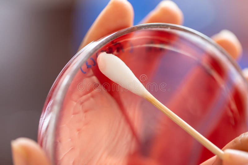 Study for Bacteria Staphylococcus Aureus in the Human Nose. Stock Photo ...