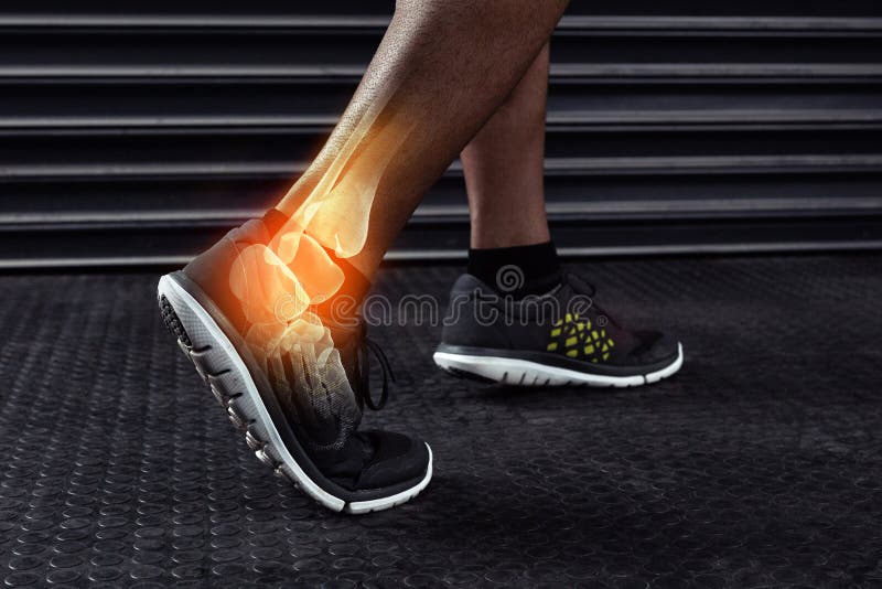 Struggling with an Ankle Injury. an Unrecognizable Man Working Out with ...